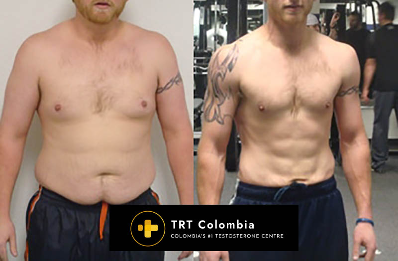 Colombia’s Best Doctors for TRT & Stem Cell Therapy | TRT Colombia